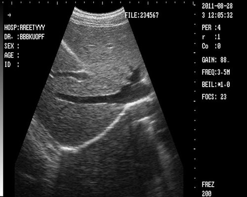 Human Portable Ultrasound Scanner with 18-month warranty/CE Ultrasonic with factory support/USG echo device/Sonography