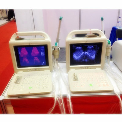 Laptop Ultrasound Scanner/CE&ISO Ultrasonic Machine/6kgs USG machine/Sono echo device with 18-month warranty