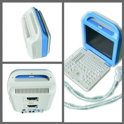 Laptop Ultrasound Scanner/CE&ISO Ultrasonic Machine/6kgs USG machine/Sono echo device with 18-month warranty
