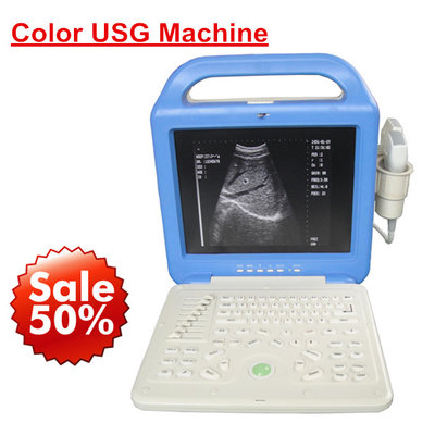 Laptop Ultrasound Scanner/CE&ISO Ultrasonic Machine/6kgs USG machine/Sono echo device with 18-month warranty