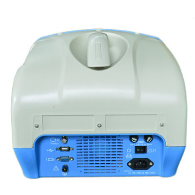 CE&ISO ultrasound scanner/Factory ultrasonic machine/Echo device/Sonography medical equipment/18-month usg scanner