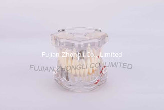 China Dentist Dental Implant Disease Teeth Model with Restoration &amp; Bridge Tooth Study supplier