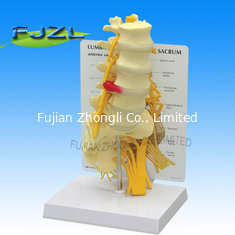 China skeleton human model 5-pc Lumbar Vertebrae with Sacrum supplier