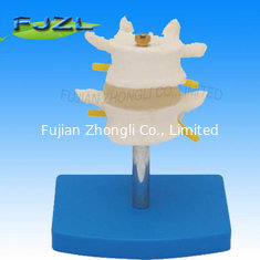 China Lumbar set(2 pcs) supplier