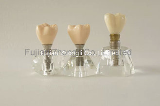 China dental implant demonstration model of 5 parts supplier