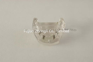 China Dental 4 Implant patient education products supplier