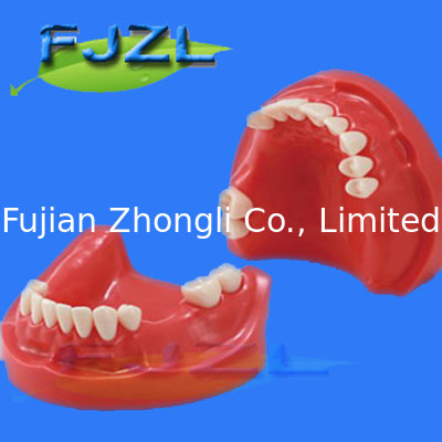 dental model for partial denture restorative supplier