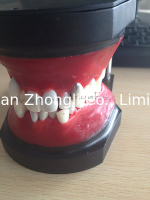 Orthodontic Models Ligature Tying Training Typodont model supplier