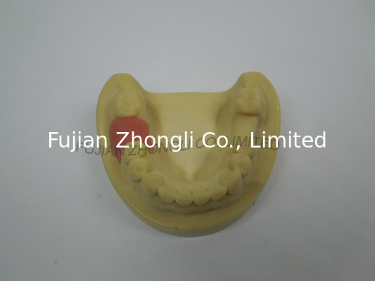 Good Quality dental implant material bone graft implant for suturing supplier