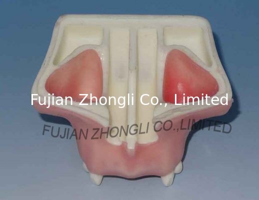 Sinus Lift Maxillary Model Sinus Grafting Operative Techniques supplier