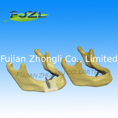 dental implant manufacturers supply dental drill model supplier