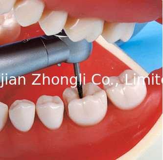 typodont teeth model with removable screw teeth supplier