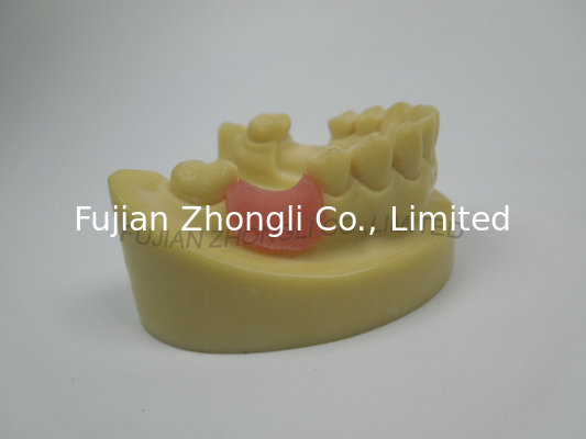 dental implant material bone graft implant for suturing supplier