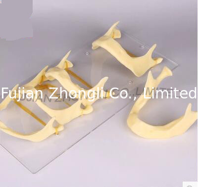 dental edentulous mandible series 5 parts supplier
