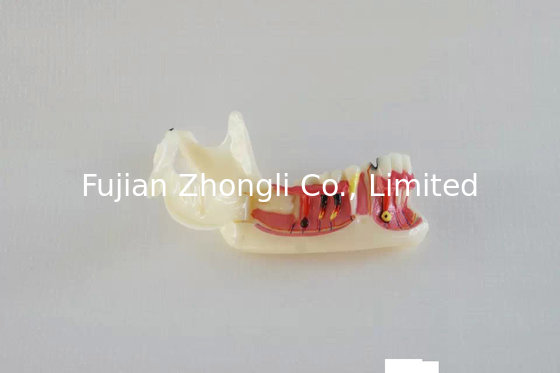 Dental Half Lower Jaw Open Gum Bone Pathological Diseases supplier