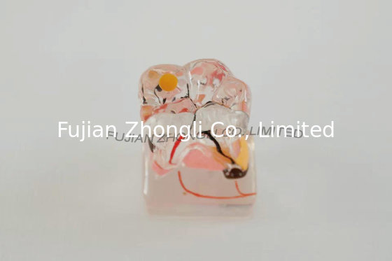 dental transparent 4 times periodontal disease model supplier