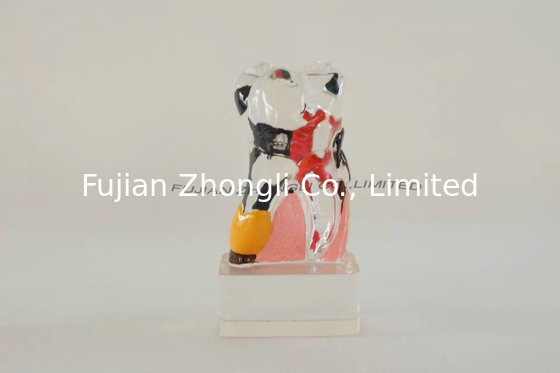dental transparent 4 times periodontal disease model supplier