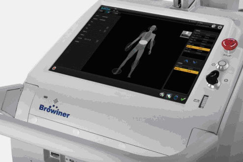 Máquina de radiografía móvil de alta frecuencia para el modelo del diagnóstico médico DRX M20/M32