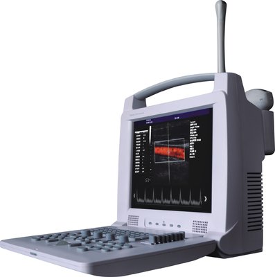máquina portátil del ultrasonido de Doppler del color 4D con cardiaco/OB/vascular
