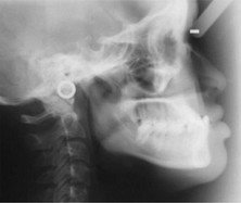 Película sensible verde de X Ray para los huesos y el examen suave los 25x30cm del tejido