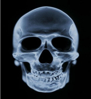 Película seca médica de la exploración de la película de la proyección de imagen, película de radiografía del laser Agfa Fuji del CT