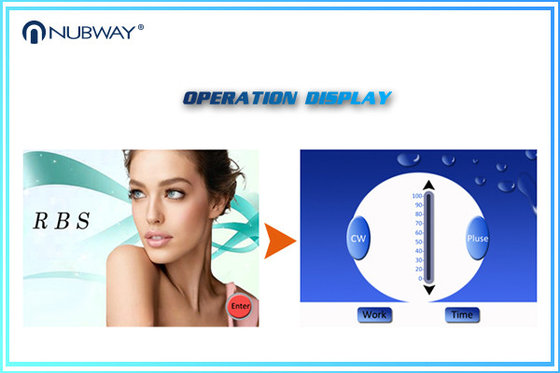 Europe hottest CE/FDA approved laser red vein vasculer treatment devices / spider vein removal beauty equipment  for sap