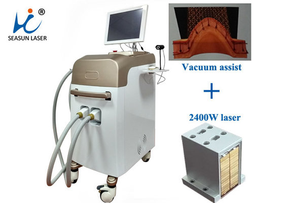Most Effective Hair Loss Treatment Permanent Hair Removal Machine For Bikini Area