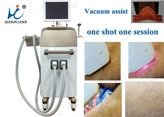 Fast Vacuum Laser Hair Removal Machine Comfortable Permanent Hair Reduction