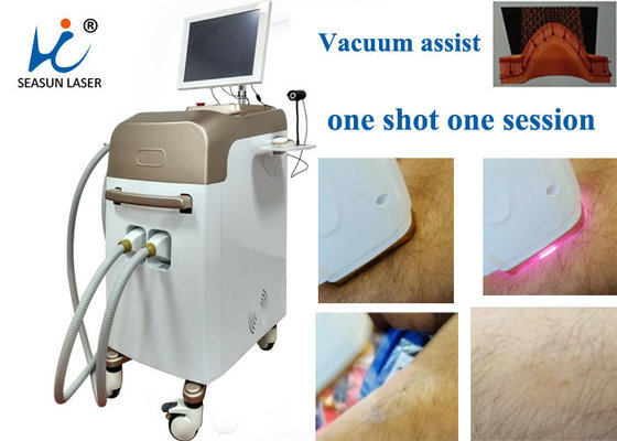 Fast Vacuum Laser Hair Removal Machine Comfortable Permanent Hair Reduction