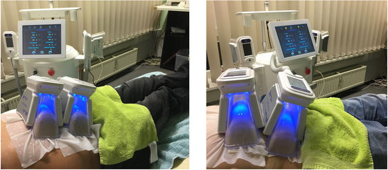 4 Handles Most advanced product cryolipolysis body slimming machine