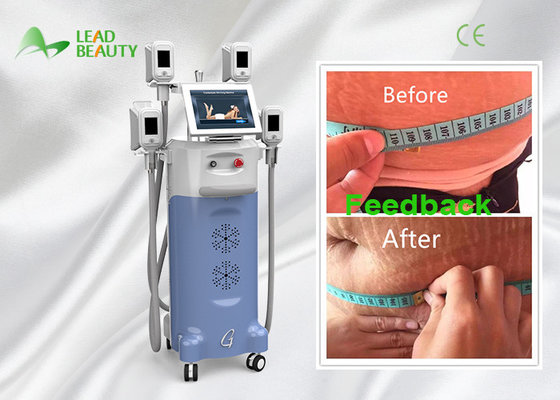 2016 hot new technology cryo fat freezing slimming machine om promotion