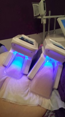 4-5cm fat lost after 1 treatment wind+water+semiconductor cooling system cryotherapy slimming machine