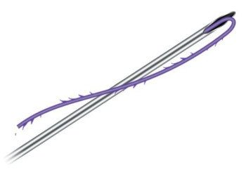Megical skin care 4d pdo thread lift