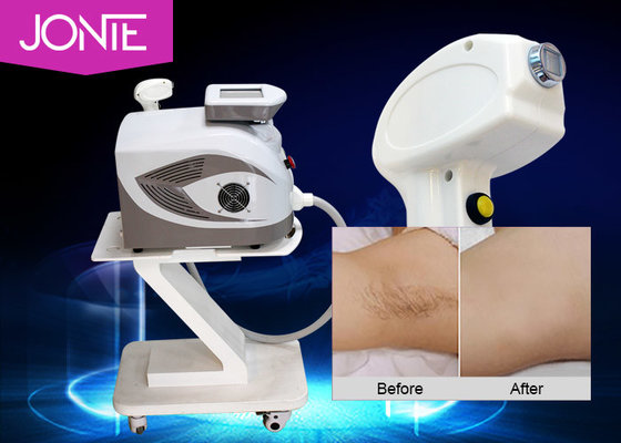 755nm diode laser hair remvoal machine for white skin and light hair