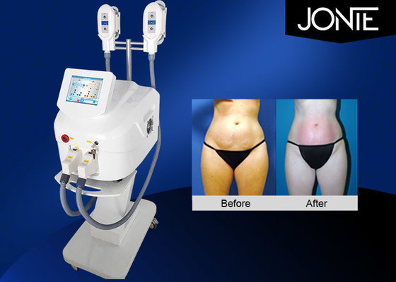 RF Vacuum Fat Freeze Slimming Machine Skin Tightening Beauty White / Gray Device