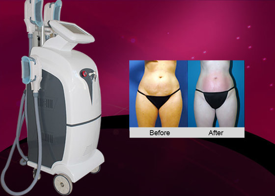 Cryolipolysis Cryotherapy Weight Loss Machine , Cryolipolysis Fat Freeze Equipment