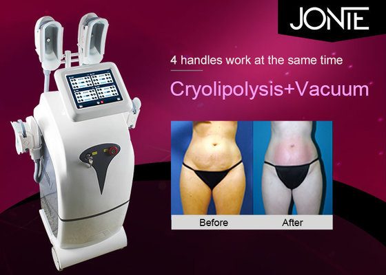 Easy to use 10 Inch Screen Cryolipolysis Body Slimming Machine with teaching video
