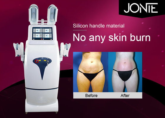 10 Inch LCD Cryolipolysis Freezing Body Shaping Machine 450mm Length