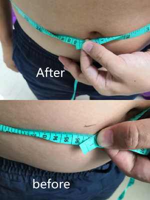 Fat freezing cryolipolysis machine with two handles for body fat reducing and double chin supplier