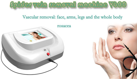 Spider vein removal beauty salon machine Best treatment for varicose and spider veins