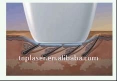 Diode Laser Hair Removal AIGaAs Diode Arrays Machine 110V / 60Hz/ 50~400ms