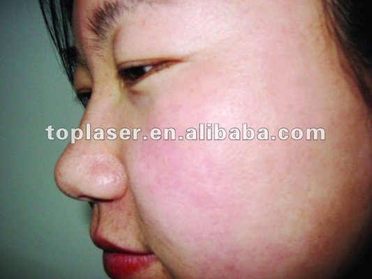 Pain Free Ipl Hair Removal Machine , IPL Beauty Skin Tightening Machine