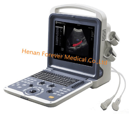 Diagnostic System Full Digital Color Doppler Ultrasound Scanner (YJ-U60)