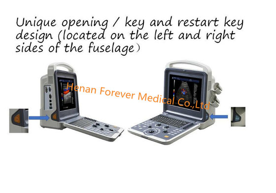 Diagnostic System Full Digital Color Doppler Ultrasound Scanner (YJ-U60)
