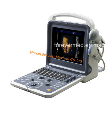 Medical Diagnosis Equipment 3D/4D Color Doppler Ultrasound