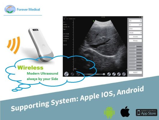 2017 High End Wireless Smartphone Ultrasound Scanner for Anesthesiology Puncture