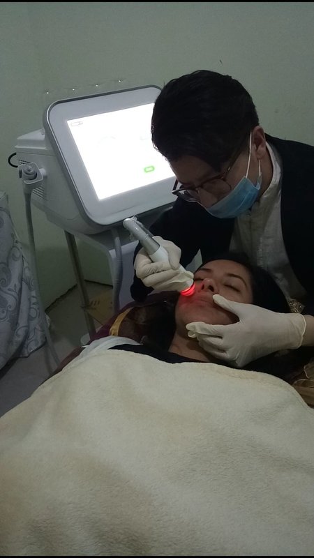 Face Lifting Microdermabrasion Peeling Machine 650nm Laser Anti - Inflammatory